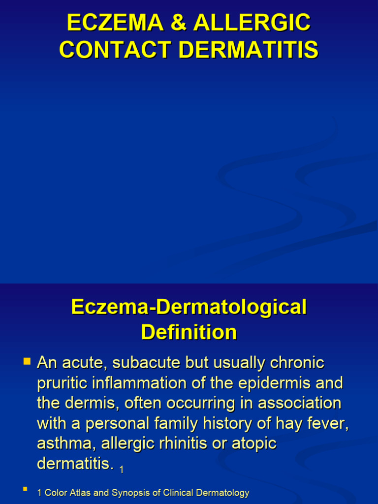 Eczema& Allergic Contact-Dermatitis | Download Free PDF | Dermatitis | Allergy