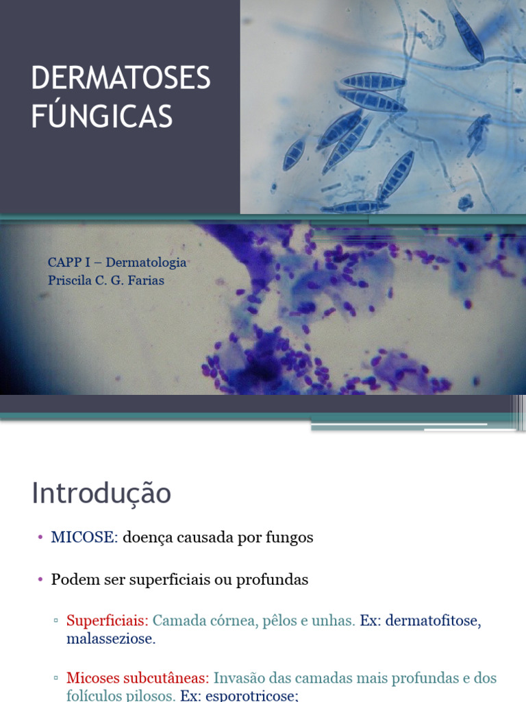 Dermatoses Fúngicas | PDF | Dermatologia | Medicina Clínica