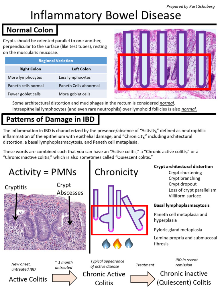 Kurt IBD Handout | Download Free PDF | Ulcerative Colitis ...