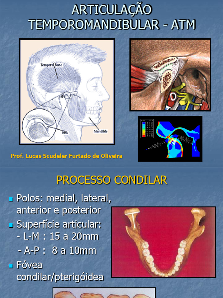 Articulação Temporomandibular - ATM | PDF | Cartilagem | Anatomia humana