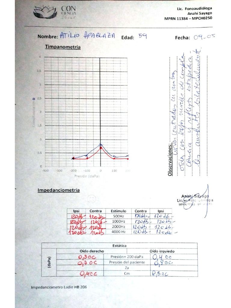 Timpanometria Impedanciometria Apablaza | PDF