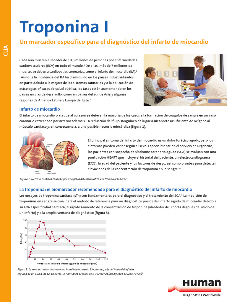 Diagnóstico del Infarto de Miocardio con Troponina | PDF | Infarto de ...