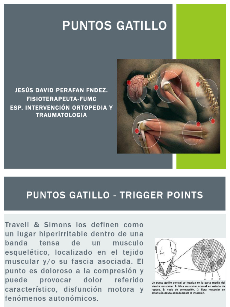 Puntos Gatillo | PDF | Punto gatillo miofascial | Dolor