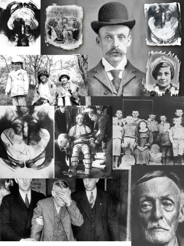 Albert fish y análisis Psicológico de su infancia | PDF | Behaviorismo ...