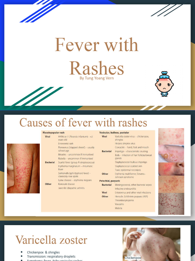 Paeds Presentation | PDF | Hepatitis | Tuberculosis