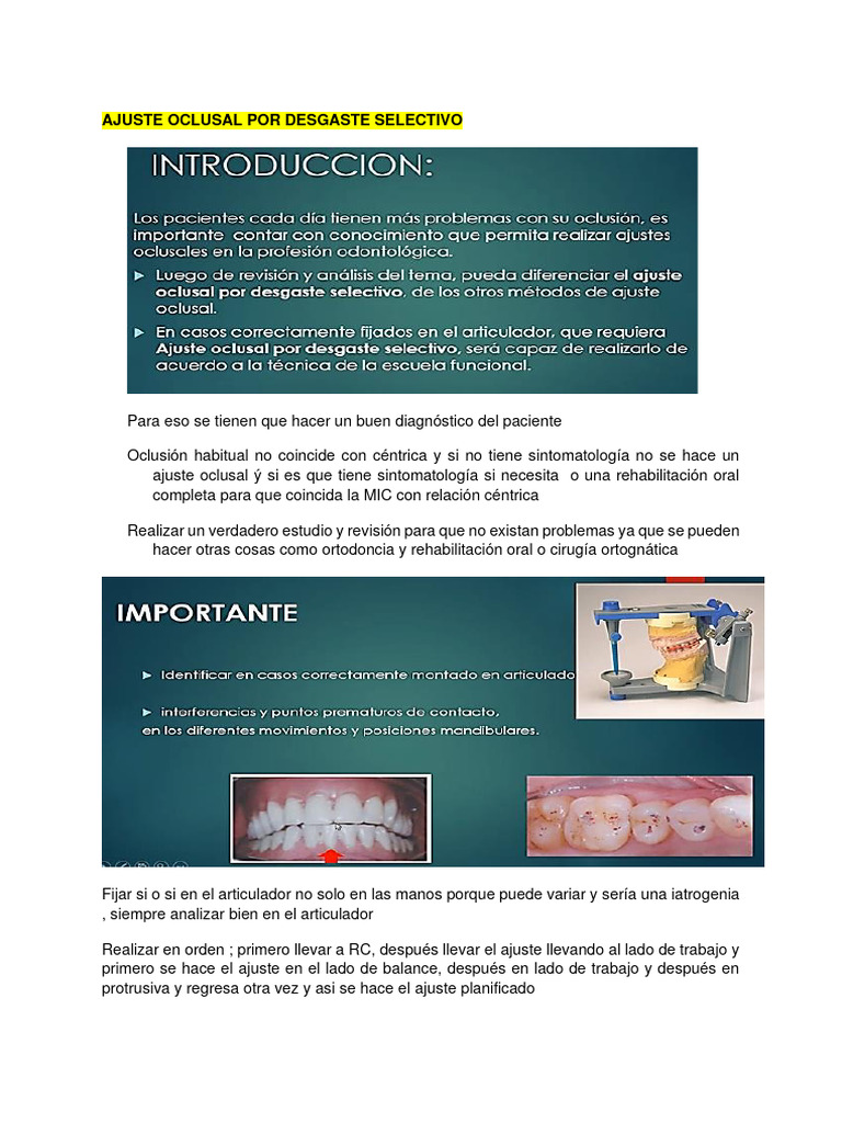 Ajuste Oclusal Por Desgaste Selectivo | PDF | Ortodoncia | Odontología