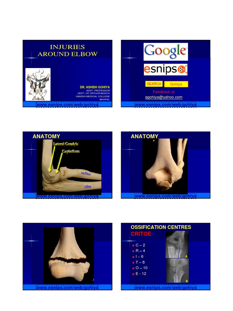 Elbow Injury Overview and Management | PDF | Elbow | Limbs (Anatomy)