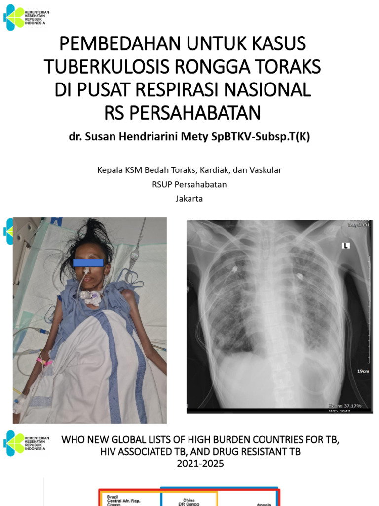 Clinical Result of TB Surgery in Persahabatan Hospital | PDF ...