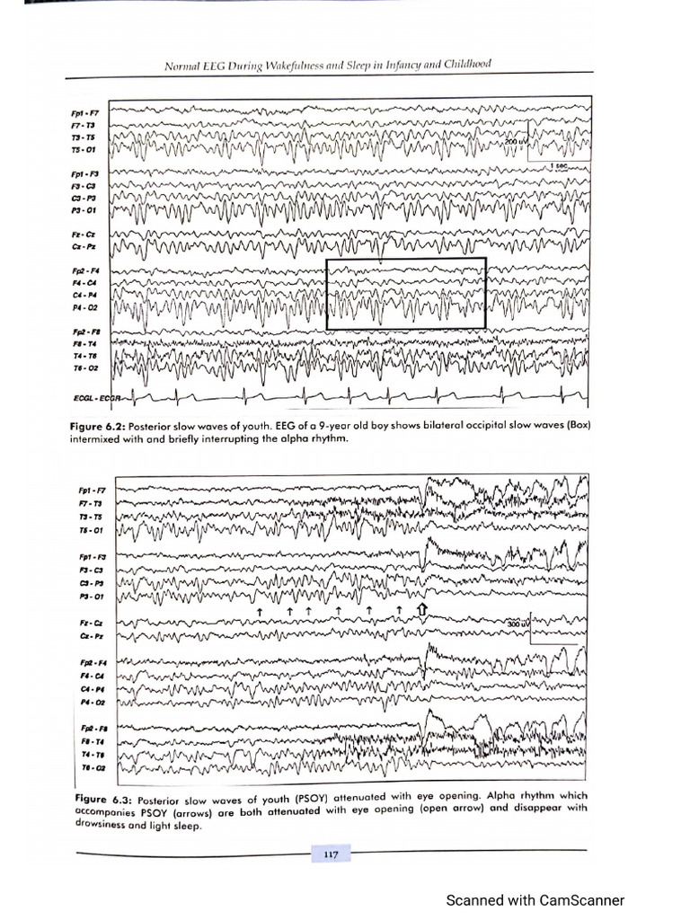 Eeg 4 | PDF