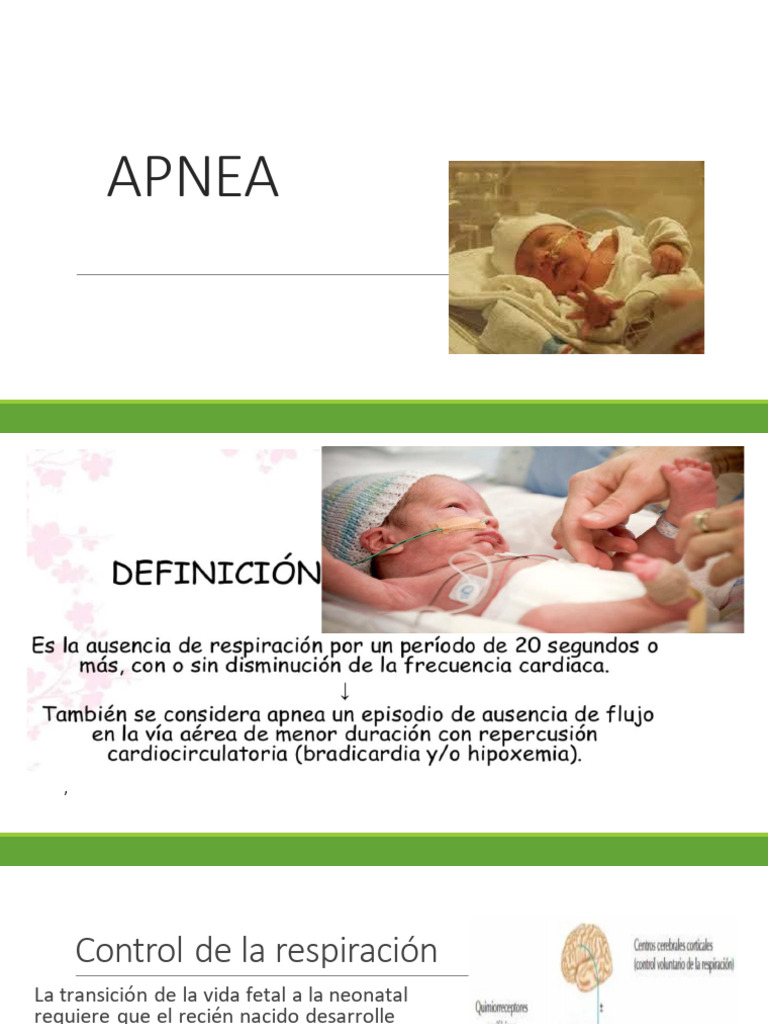 Apnea Neonatal: Manejo y Diagnóstico | PDF | Apnea | Sistema respiratorio