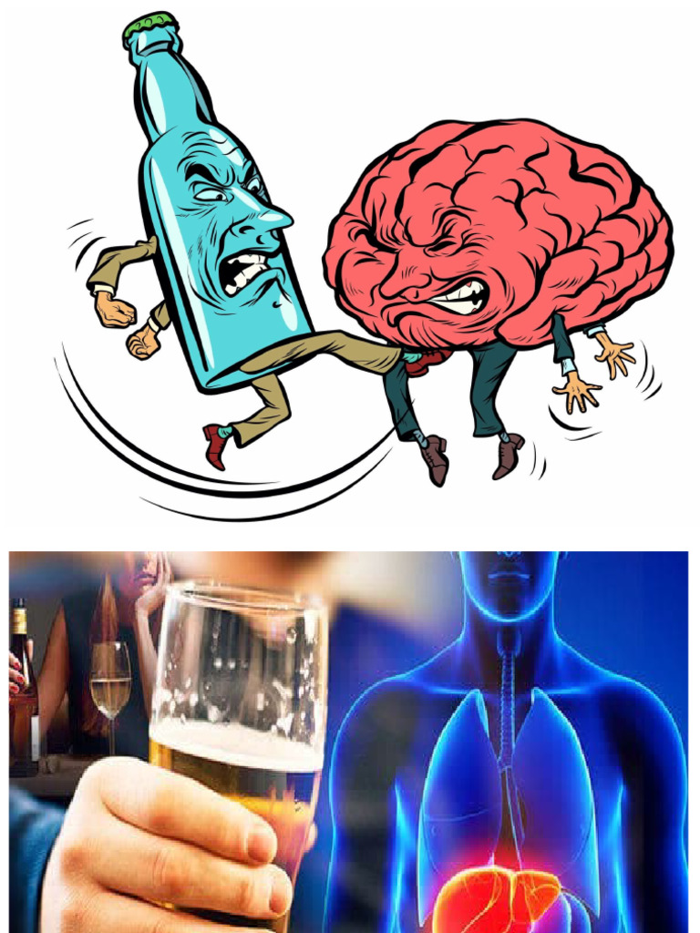 Imagenes Sobre Consumo de Alcohol | PDF