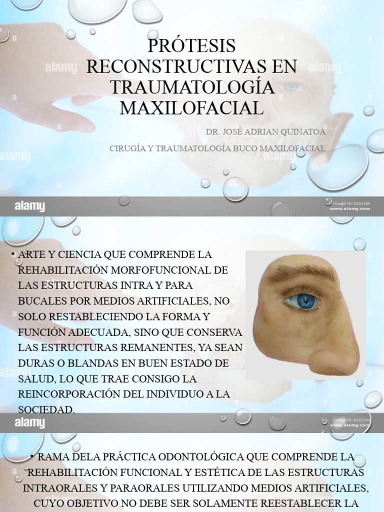 Prótesis Reconstructivas en Traumatología Maxilofacial | PDF