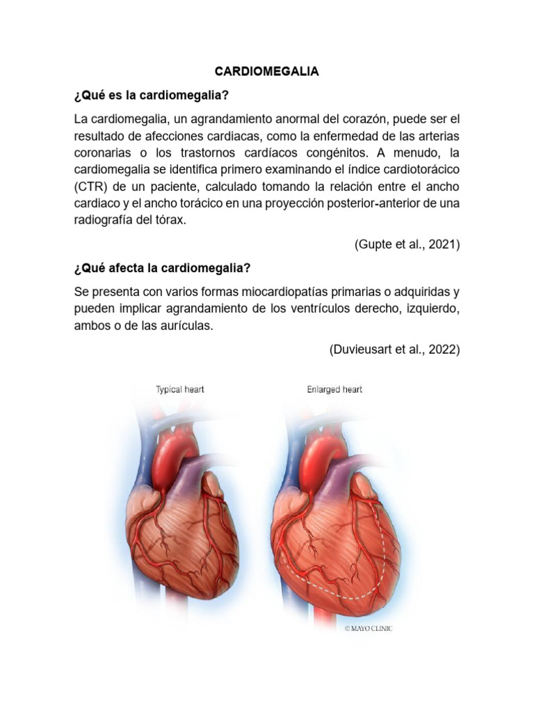 Cardiomegalia: Causas y Diagnóstico | PDF