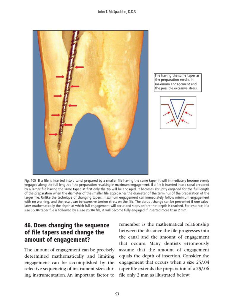 Optimizing File Engagement in Endodontics | PDF | Curvature | Fatigue ...