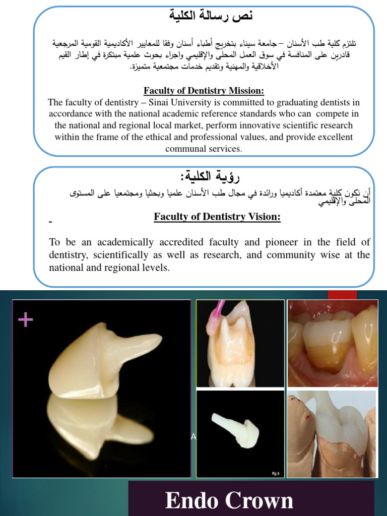 Endo Crown Handout | Download Free PDF | Dentistry | Tooth