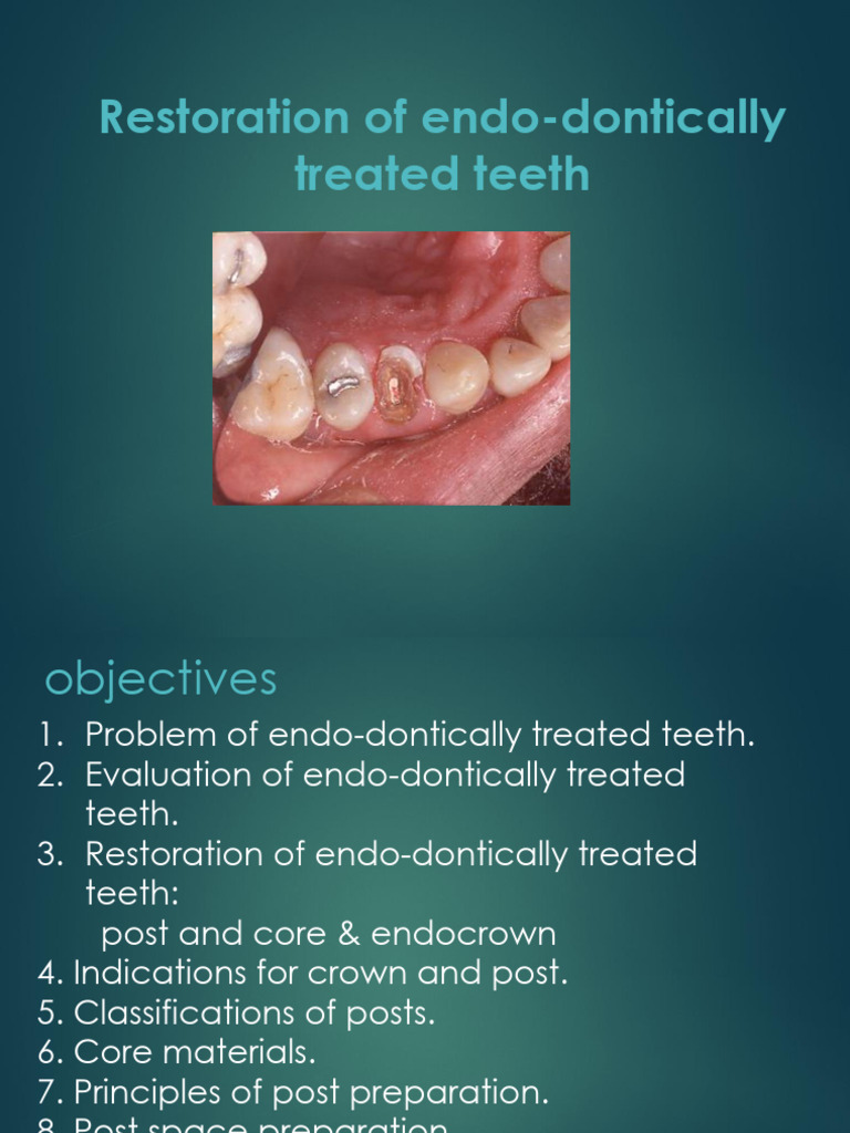 Endodontically teeth | PDF | Human Tooth | Tooth