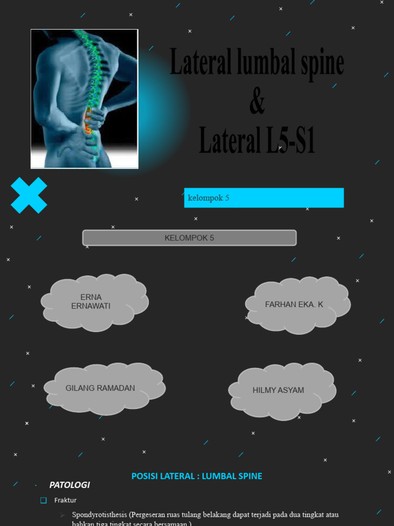 Posisi Lateral Radiografi Lumbal | PDF