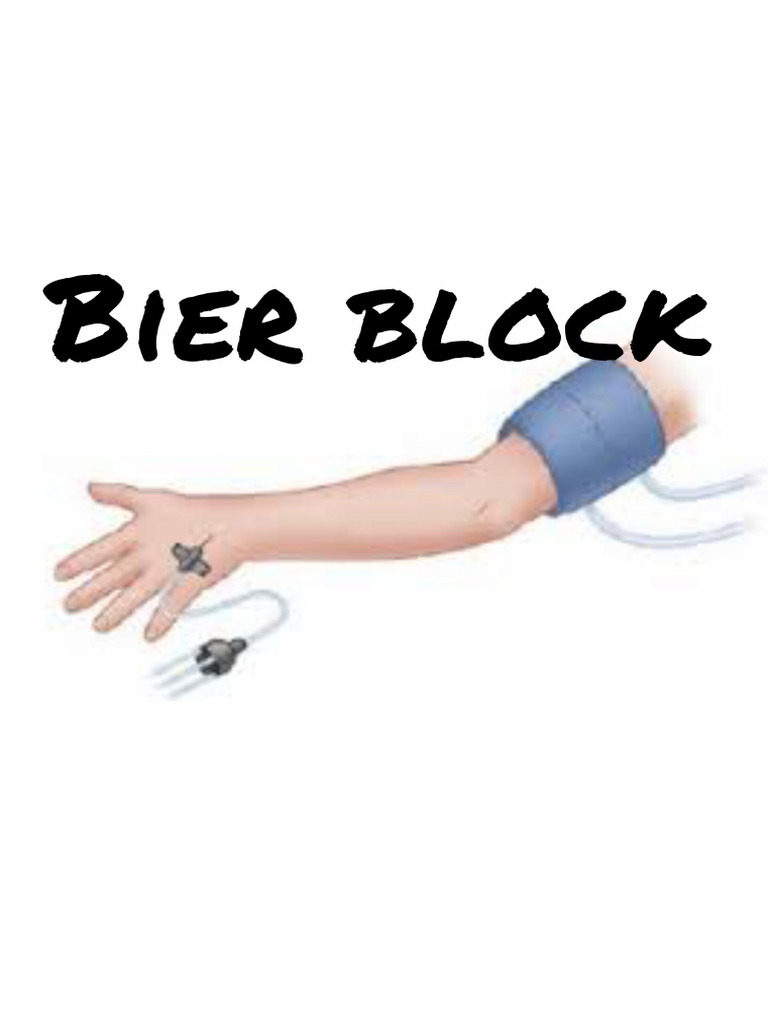 Bier Block | PDF