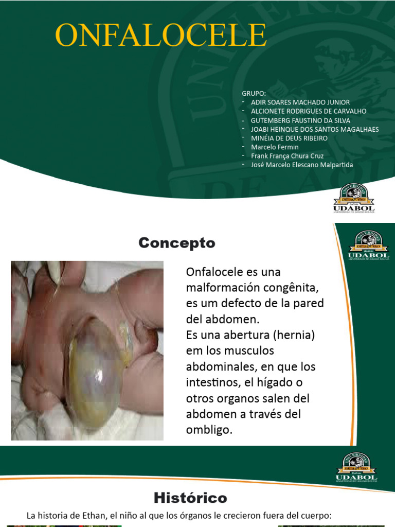 Exposicion Onfalocele | PDF | Ultrasonido | Feto