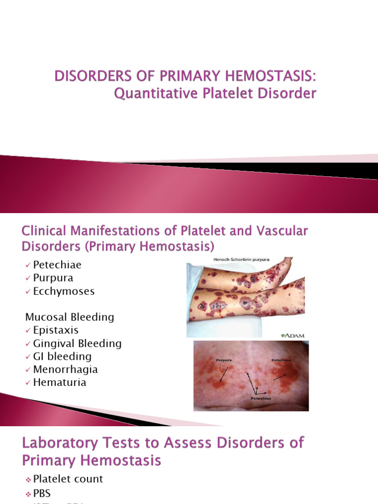 Quantitative Platelet Disorder | PDF | Platelet | Diseases And Disorders