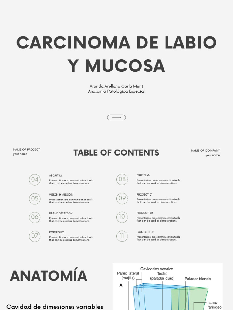 Carcinoma de Labio y Mucosa: Diagnóstico y Tratamiento | PDF | Lengua ...