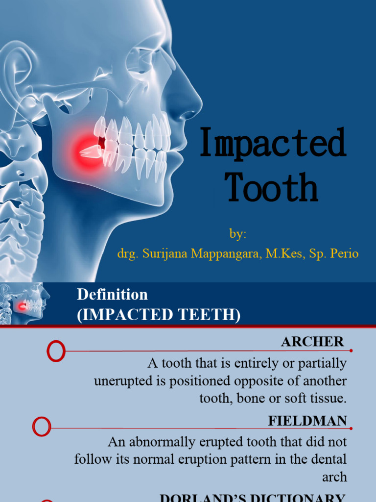 Edit 3 Gigi Impaksi, Klasifikasi, & Penatalaksanaannya 2018 (Autosaved ...