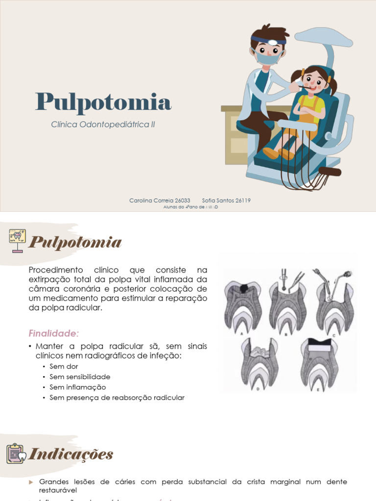 Protocolo de Pulpotomia | PDF | Dente humano | Dentina