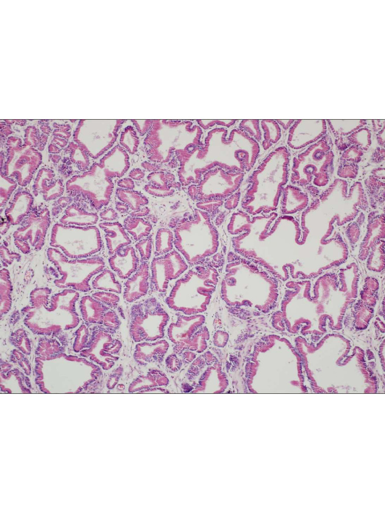 Prostata Normal | PDF