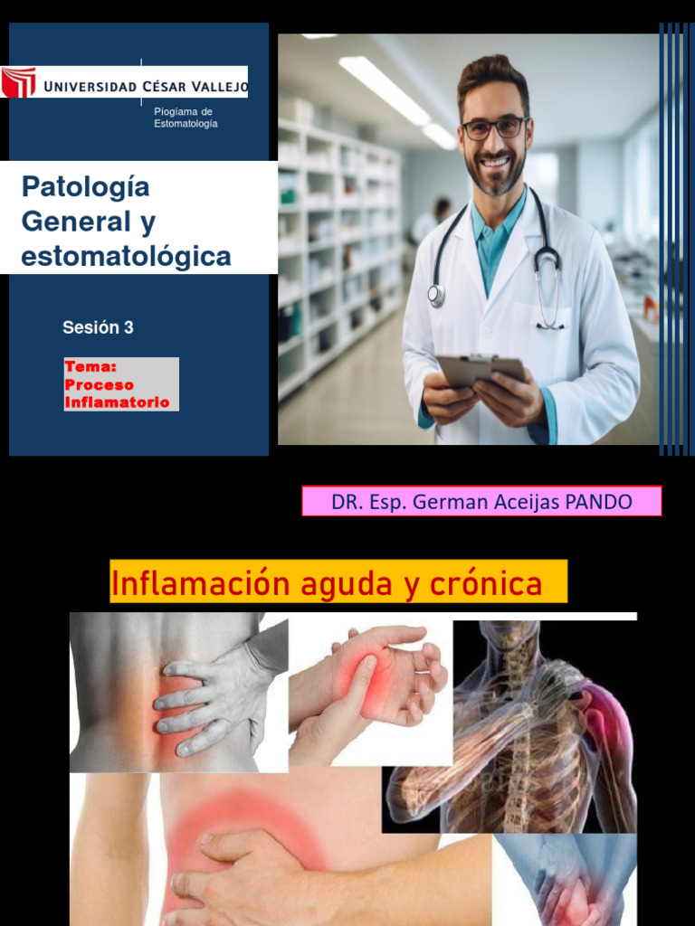 Proceso Inflamatorio en Estomatología | PDF | Inflamación ...