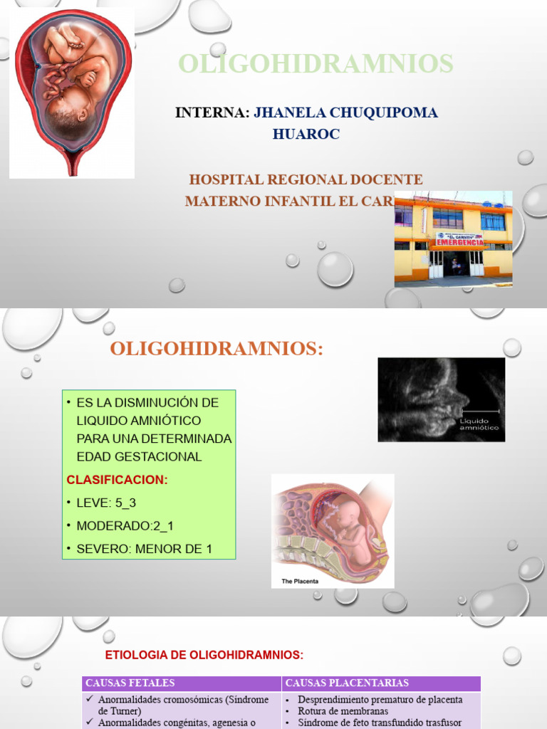 Oligohidramnios: Causas y Manejo | PDF