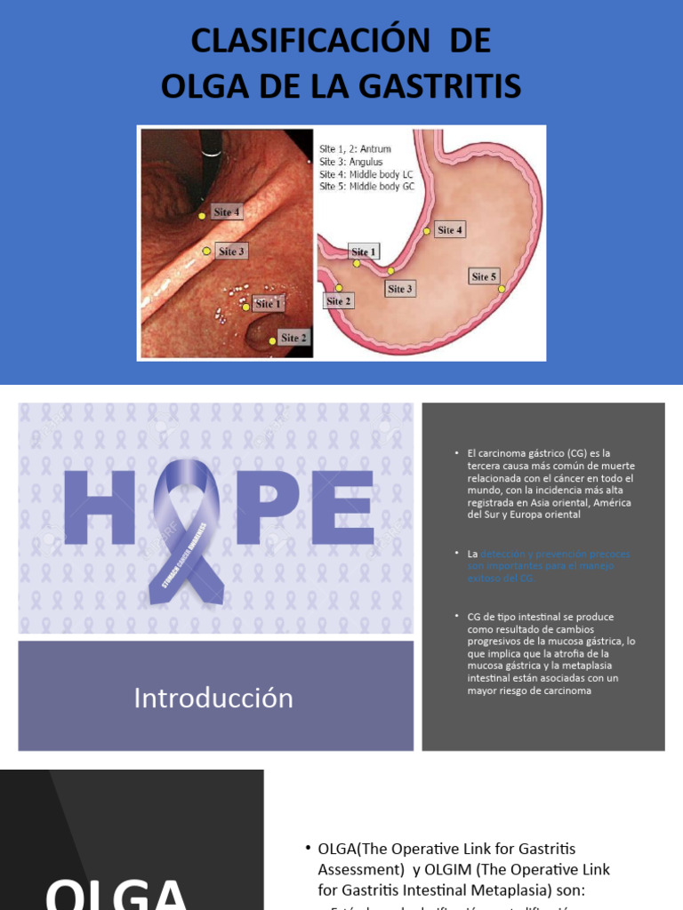 Clasificacion de Olga de La Gastritis | PDF | Estómago | Sistema digestivo