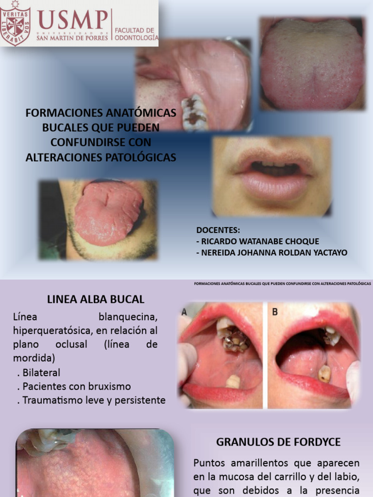 Formaciones Bucales y Su Confusión Patológica | PDF | Lengua ...