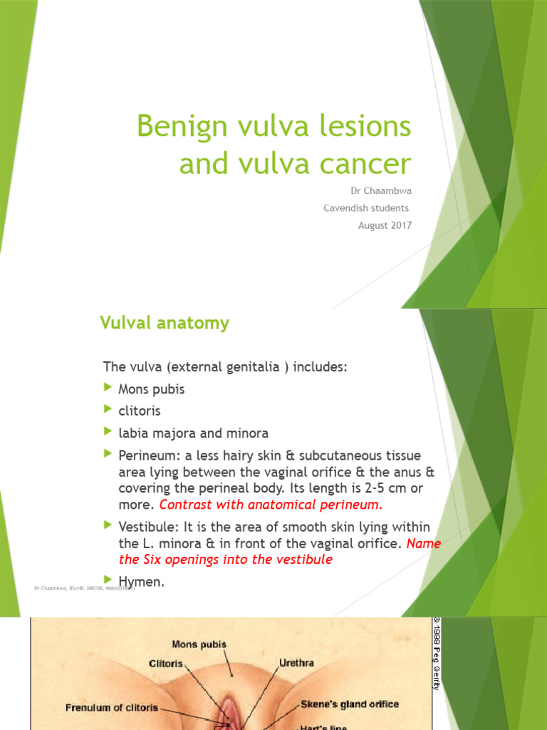 Benign Vulva Lesions | Download Free PDF | Medical Specialties ...