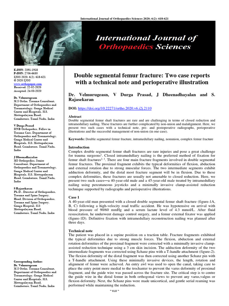 Double Segmental Femur Fracture Two Case Reports W | PDF | Anatomical ...
