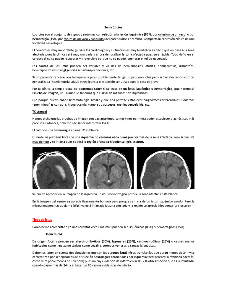 Ictus | PDF | Carrera | Trombosis