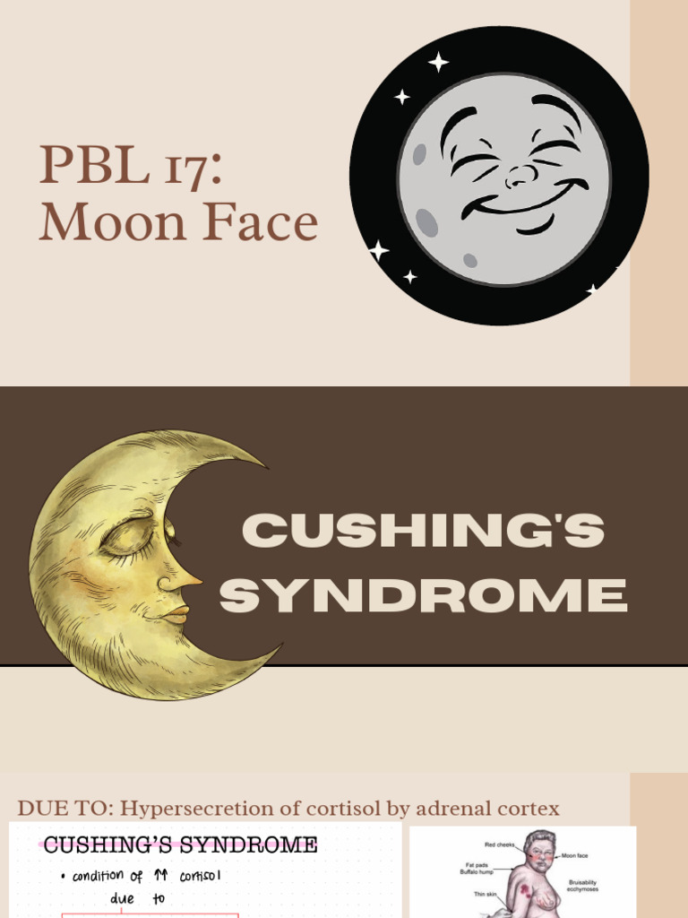 PBL 17 Moon Face | PDF | Cortisol | Adrenocorticotropic Hormone