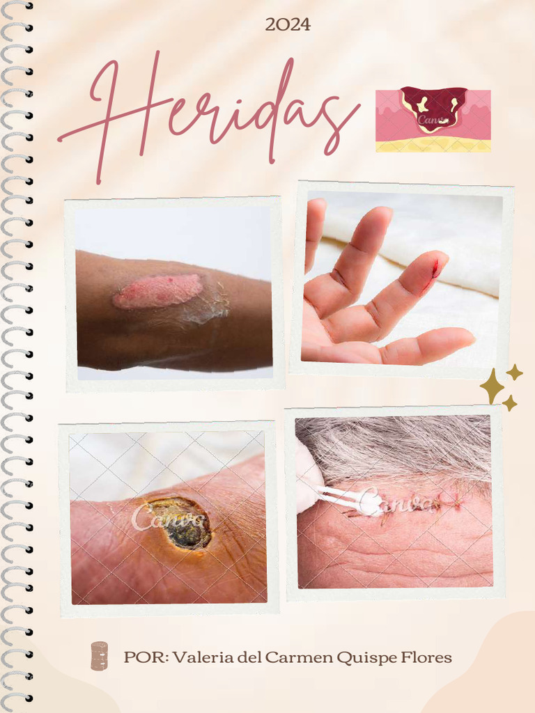 Galería de Fotos - Heridas y Cicatrices - Compressed | PDF | Causas de ...