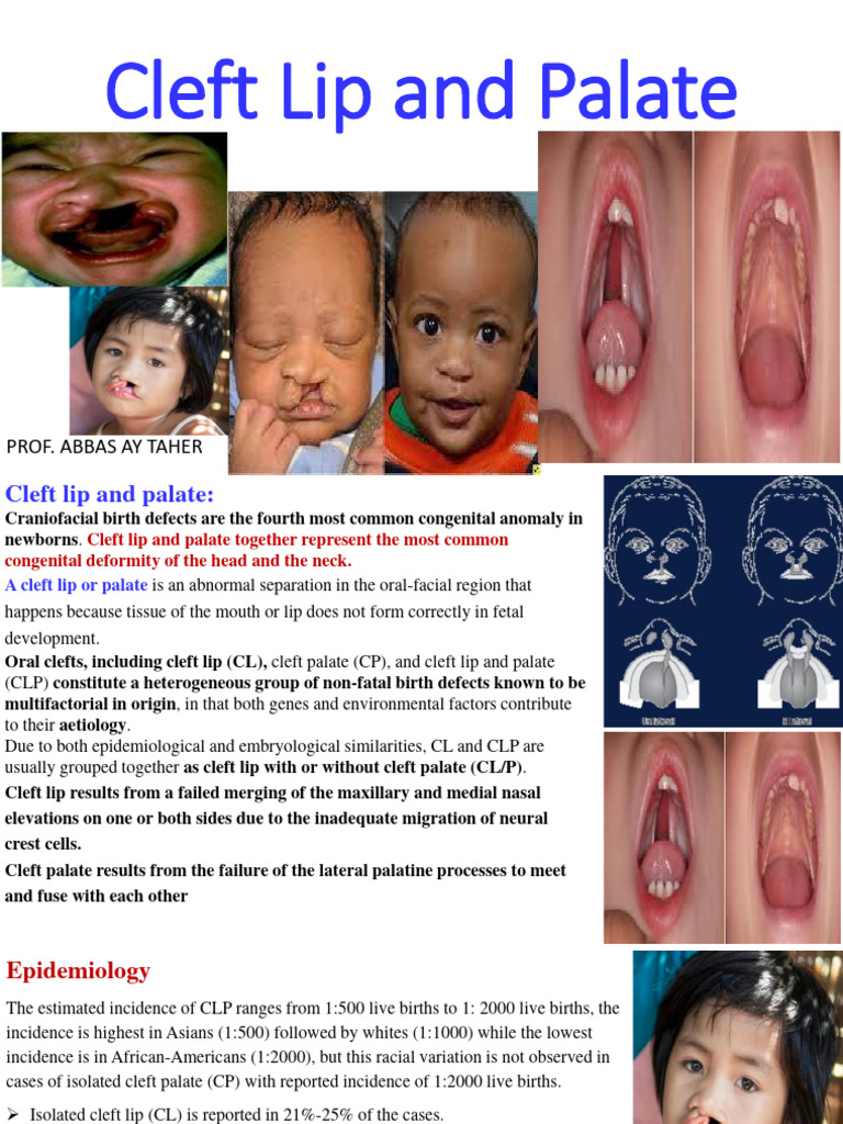 Cleft Lip and Palate Fifth 2023 | PDF | Bone | Medical Specialties