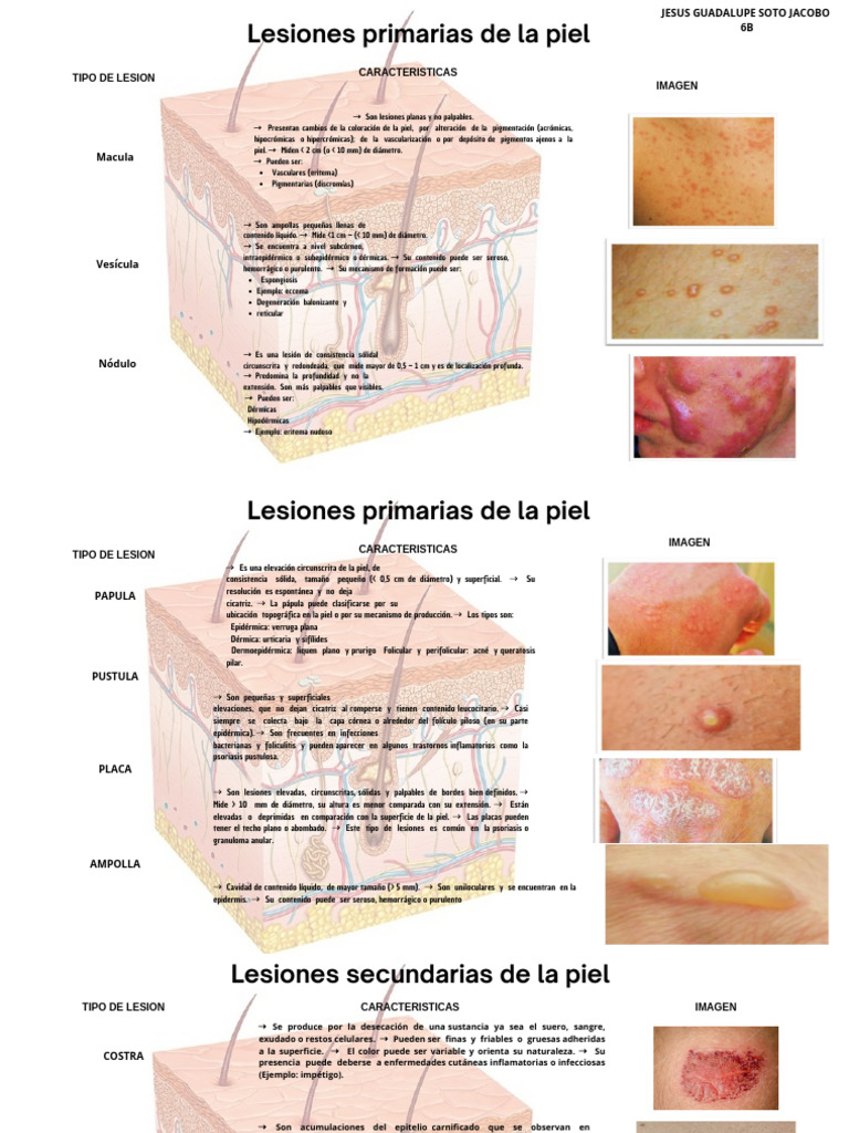 Lesiones Primarias y Secundarias Clinica | PDF | Piel | Psoriasis
