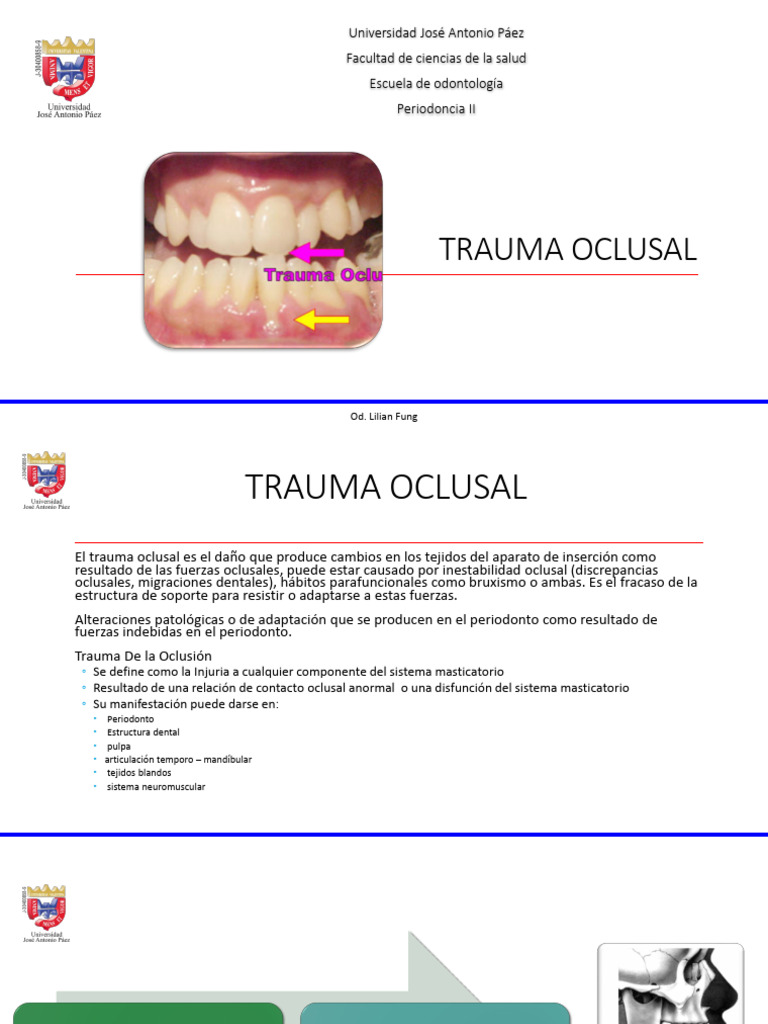 Traumar Oclusal | Descargar gratis PDF | Medicina CLINICA | Anatomia dental