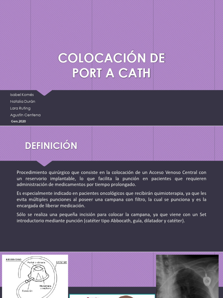 Colocación de Port a Cath: Guía Completa | PDF | Vena | Cirugía