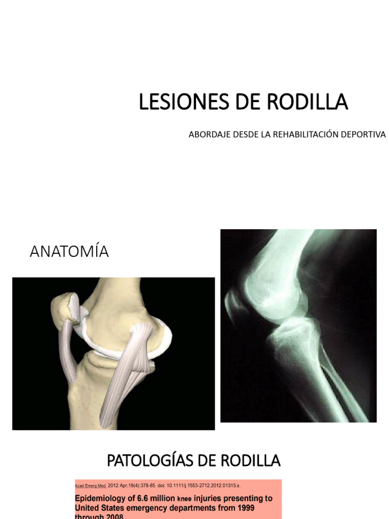 Patologías Comunes de Rodilla en Deportistas | PDF