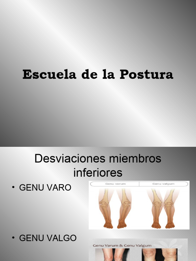 Desviaciones de Rodilla: Genu Valgo y Varo | PDF | Pie | Rodilla