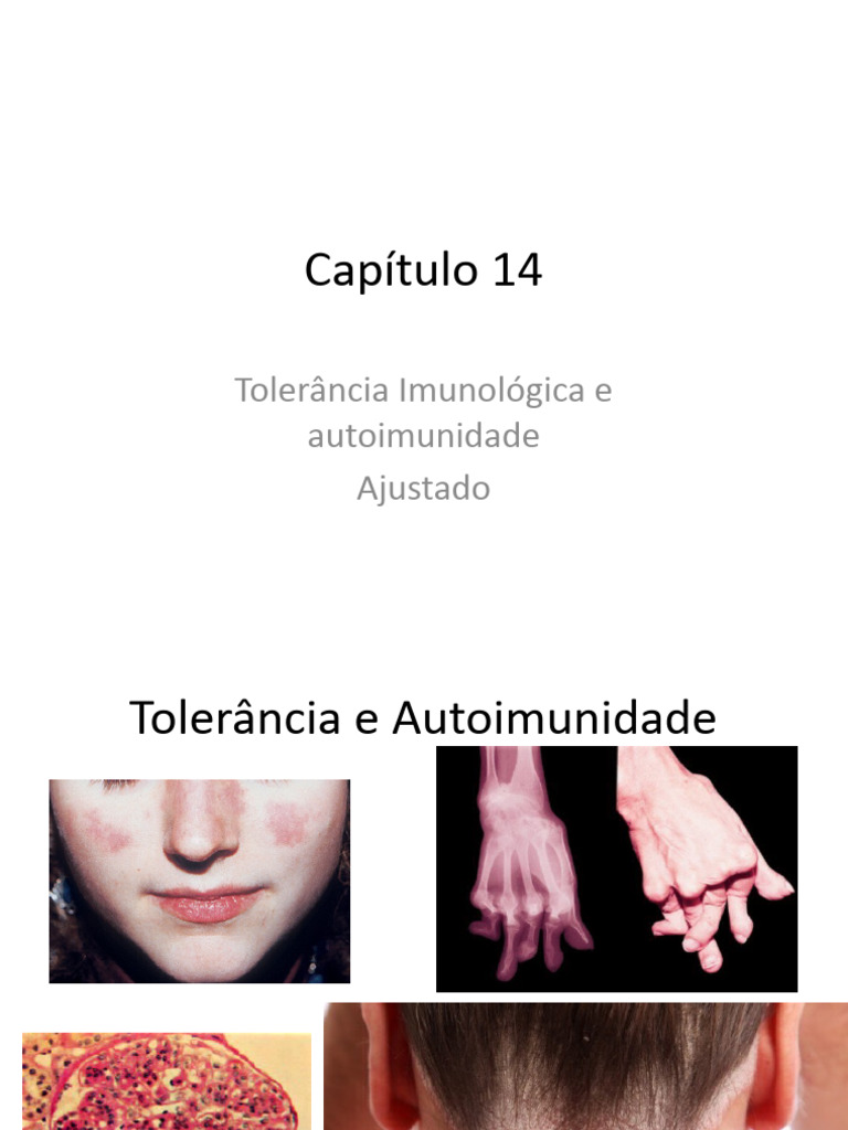 Tolerância Autoimunidade | PDF | Imunologia | Autoimunidade