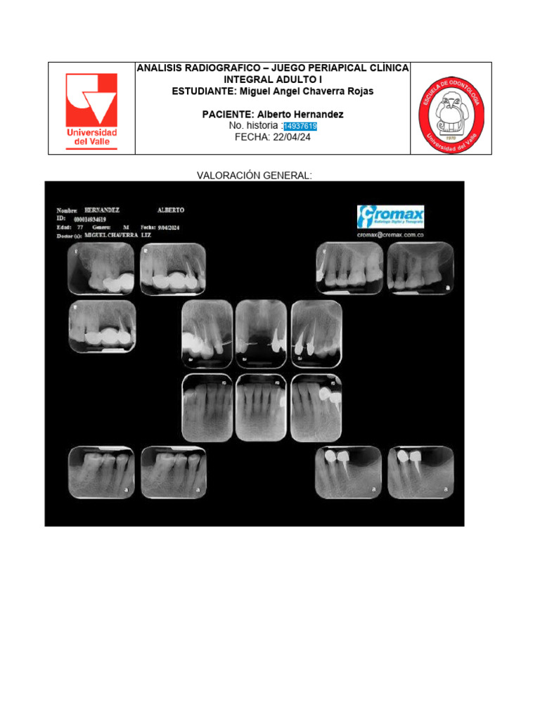 Análisis Radiográfico del Juego Periapical | PDF | Ciencias sociales ...