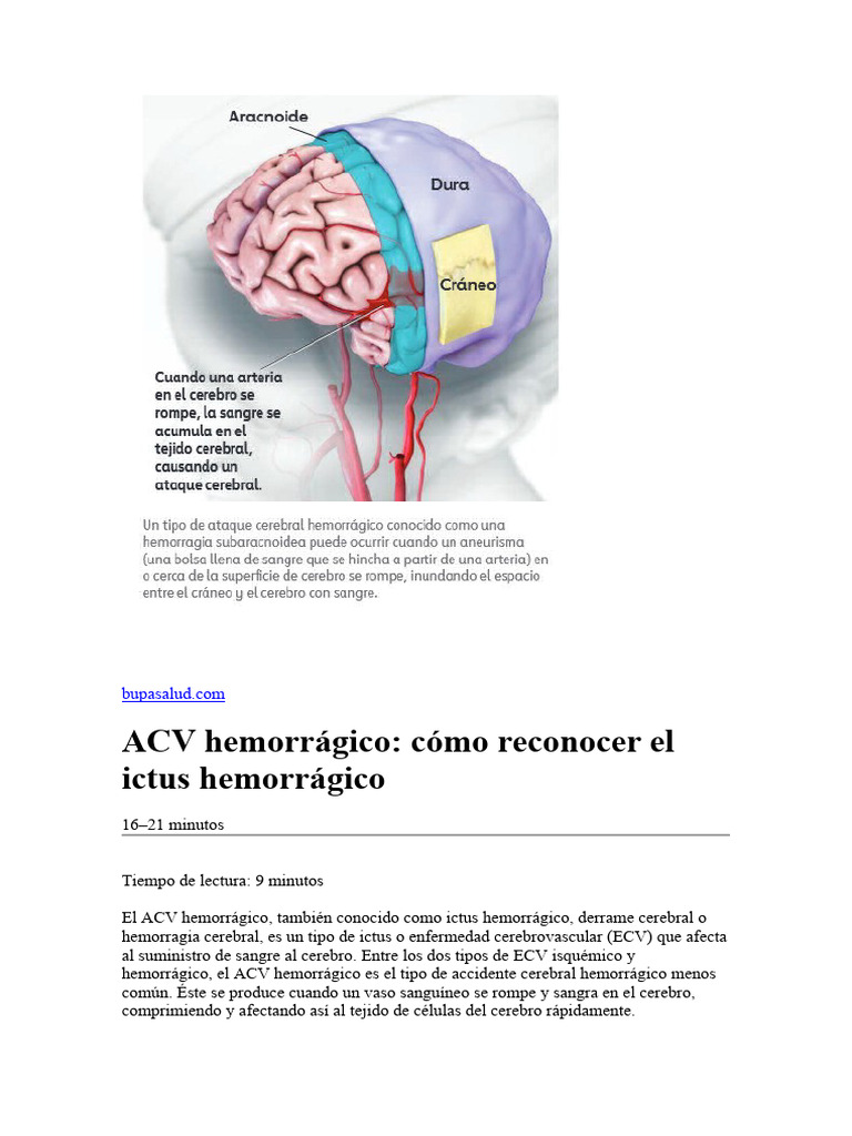 ACV Hemorragico | PDF | Carrera | Medicina