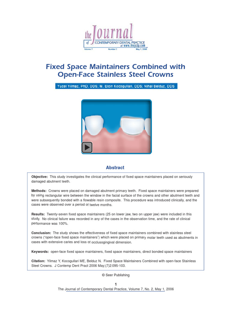 Fixed Space Maintainers with SSCs | PDF | Dental Composite | Human Tooth