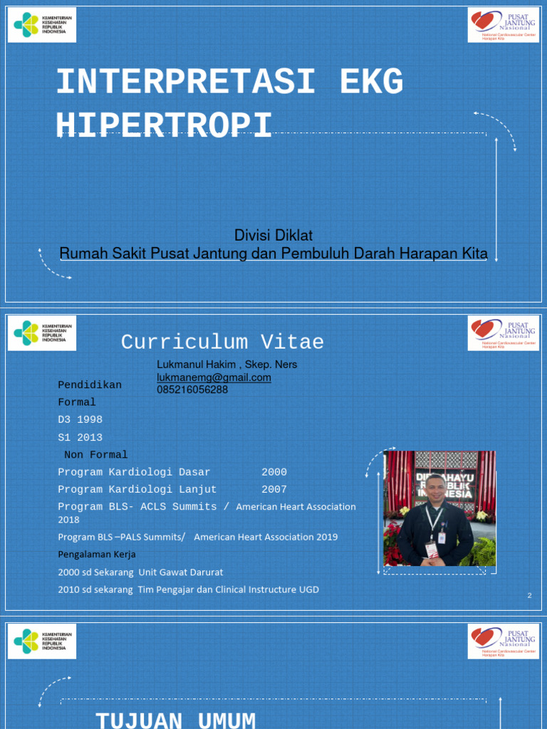 EKG Hipertropi 2023 PDF | PDF
