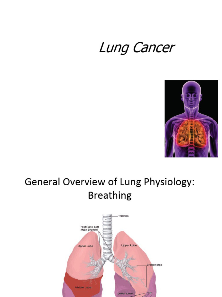 Lung Cancer Presentation Final | PDF | Lung Cancer | Metastasis