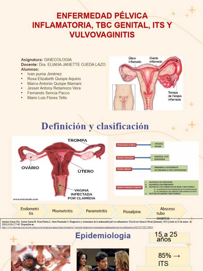 Enfermedad Pelvica Inflamatoria FINAL | PDF | Tuberculosis | Infección transmitida sexualmente